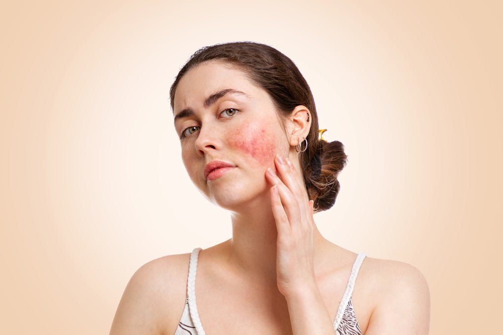 Compromised Skin Barrier: What It Is And Why You Should Care